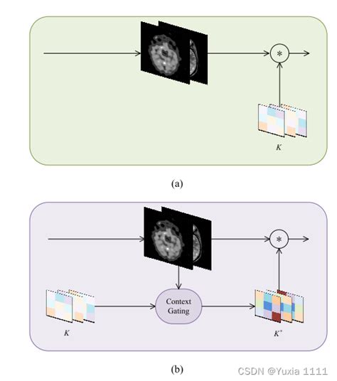 Matr多尺度自适应变压器的多模态医学图像融合matr Multimodal Medical Image Fusion Via