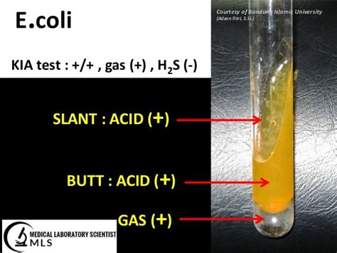 Laboratory Features Of Escherichia Coli