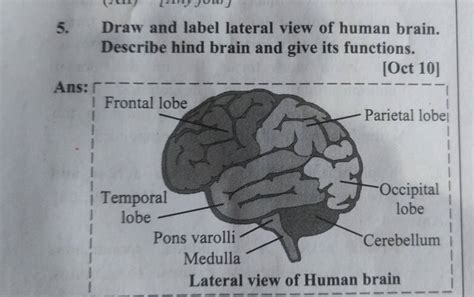 Brain Lateral View Draw