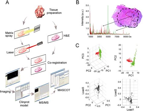 Maldi Ims Analyses Of Oscc And Adjacent Non Cancerous Osf Areas A