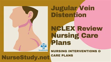 Jugular Vein Distention Jvd Causes And Treatments 57 Off
