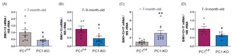 Ijms Free Full Text Polycystin 1 Is A Crucial Regulator Of Bin1