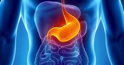 Operación de Hernia de Hiato Precio en Córdoba Argentina