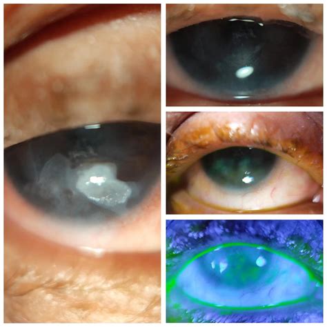 Quikvue Fan Story Visuscience