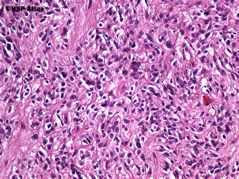 HSP Atlas Histopathology Atlas GI Tract