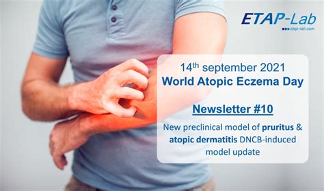 Newsletter 10 New Preclinical Model Of Pruritus And Update To Our