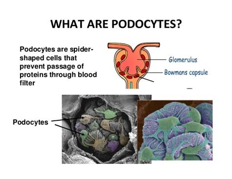 Fabry Disease Urinary Podocyte Loss 14 February 2014