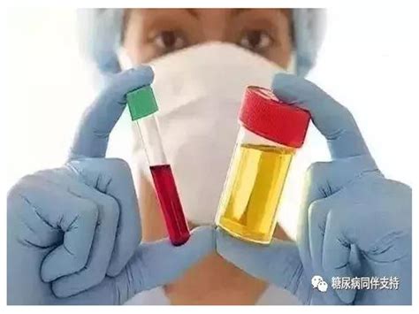 糖尿病有這四個信號，可能是腎病發生，防腎病請注意這些細節 Peekme