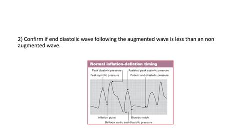 Iabp Troubleshooting And Management Pdf