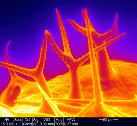 Scanning Electron Micrograph Of Leaf Trichomes That Have Been Colorized