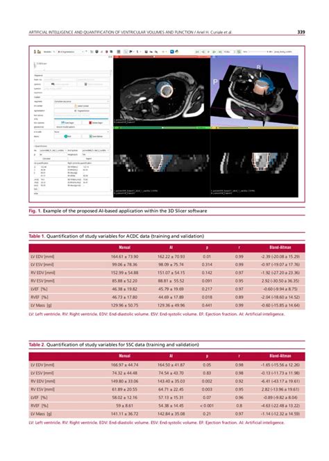 Automatic Quantification Of Volumes And Biventricular Function In Cardiac Resonance Validation