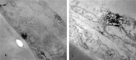 Figure Immunolocalization Of CB R Left Panel And Download
