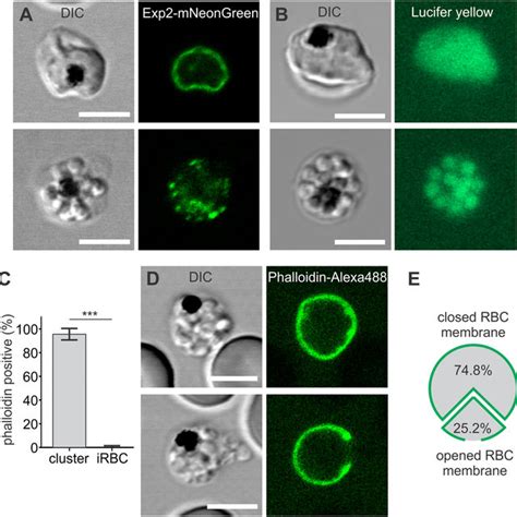 Heparin Inhibits Erythrocyte Membrane Rupture But Not Pv Membrane