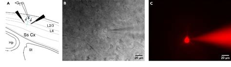 Figure 1 From Protocol For Quantifying Pyramidal Neuron Hyperexcitability In A Mouse Model Of