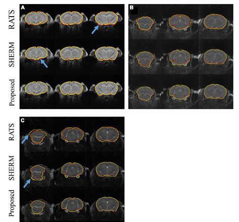 Figure 2 From Automated Skull Stripping In Mouse Functional Magnetic Resonance Imaging Analysis