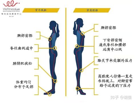 一样的腰痛，不一样的诱因 知乎
