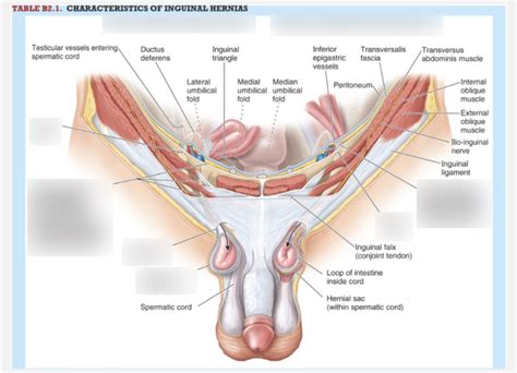 Inguinal Hernias Diagram Quizlet