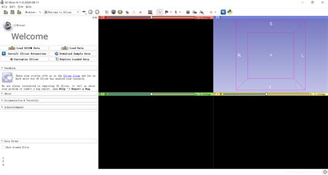 有关编译3d slicer遇到的一些坑 3d slicer 编译 csdn博客