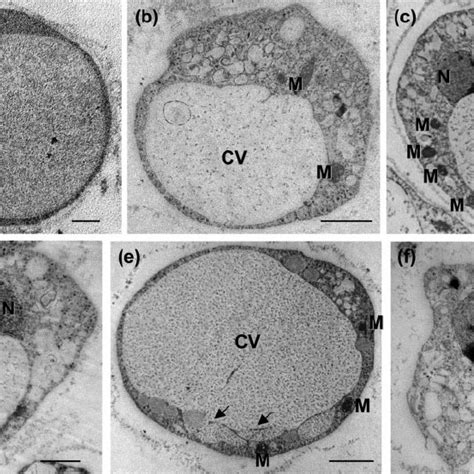 Effect Of Sts On Blastocystis Cell Size As Analysed By Flow Cytometry