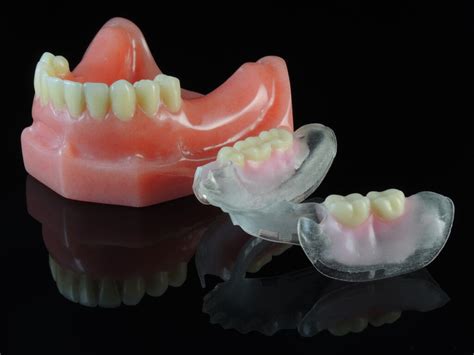Removable Partial Dentures Easy Bite Denture