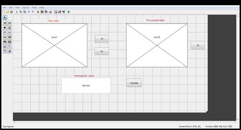 I Need A Matlab Code To Read The Data From Arduino Chegg