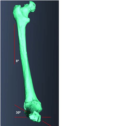 Figure S6 The Left Leg Of Individual 1 Showing The Rotation Of The Download Scientific Diagram