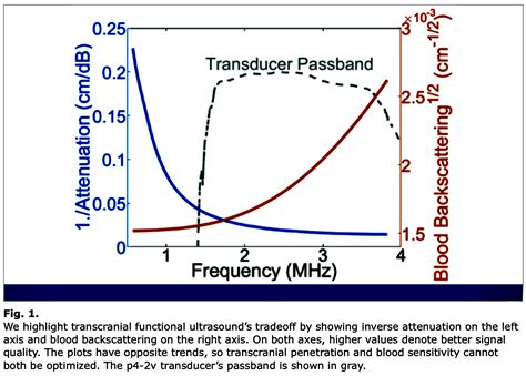 Reliable Transcranial Functional Ultrasound In An Adult Cohort N13