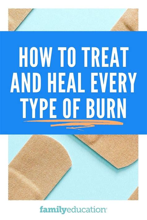 First Aid For Burns How To Treat And Heal Every Type Of Burn Burns