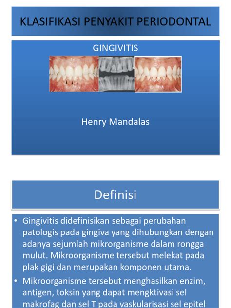 8 Gingivitis Pdf