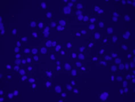 Apoptosis Induction