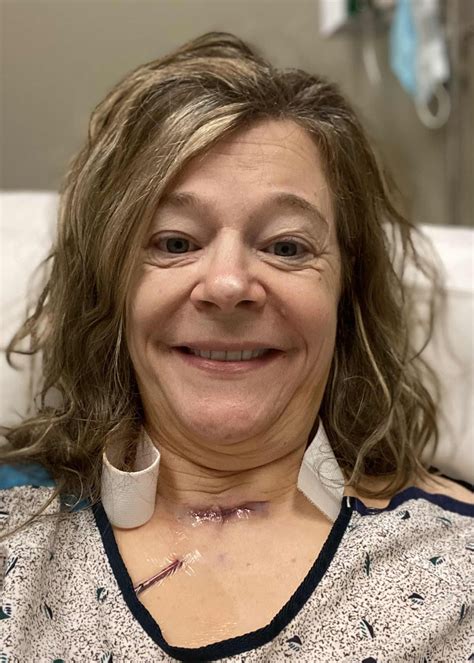 Surgery Hyperparathyroidism