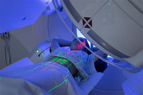 Concurrent Radiation Boost Comparable To Sequential Boost In High Risk Breast Cancer Cancer