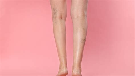 The Best 10 Compression Stockings For Varicose Veins Fitnature
