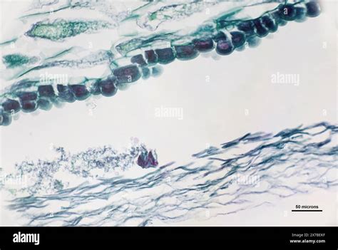 Germinating Pollen Longitudinal Section Stigma Under A Light Microscope At 40 Times