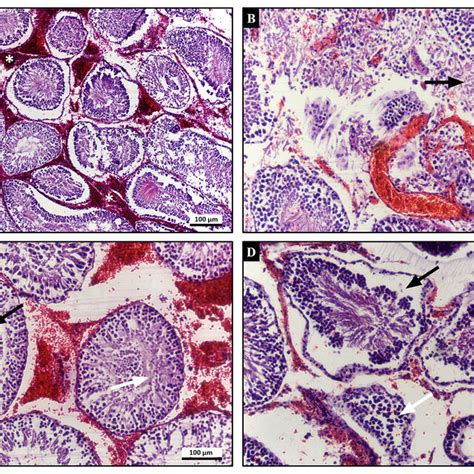Representative Photomicrographs Of Hande Stained Testicular Sections Of