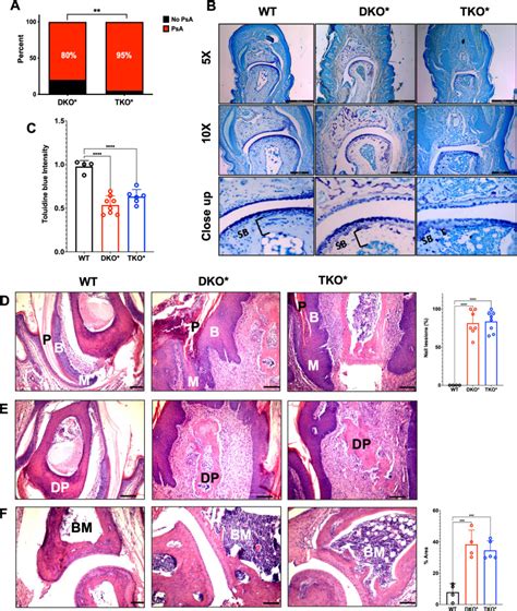 Keratinocyte Derived S100a9 Modulates Neutrophil Infiltration And