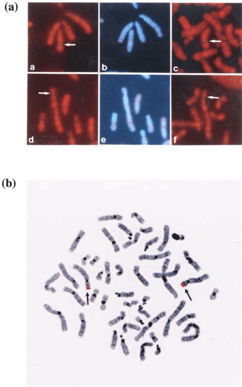 Chromosomal Mapping Of Mouse Rat And Human Ahrr Gene A Chromosomal Download Scientific