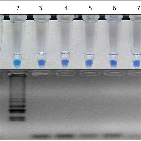 Sensitivity Of Lamp Vs Conventional Pcr Detection By A Lamp And Hnb Download Scientific