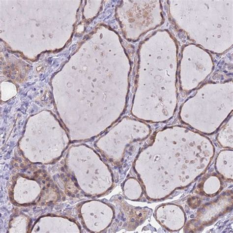 Rabbit Polyclonal Anti Marveld2 Antibody Buy For Research Highly