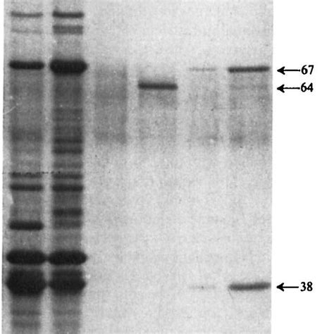 Identification Of Transferrin Binding Polypeptides Isolated From A Download Scientific Diagram
