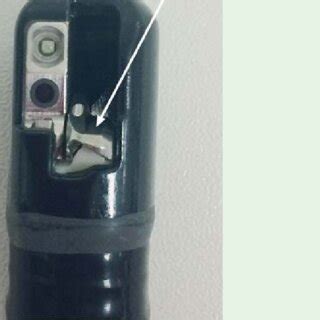 Head ERCP Scope With Forceps Elevator Download Scientific Diagram