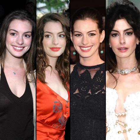 Anne Hathaway Plastic Surgery Before After Plastic Surgery Lip My Xxx Hot Girl