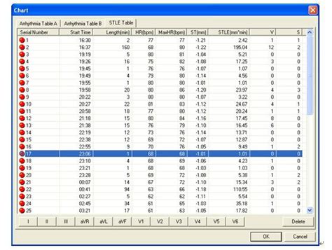 Cefda는 표시 24 시간 12 채널 홀터 홀터 Ecg Tlc5000홀터 모니터 Buy 홀터 모니터혈압 홀터