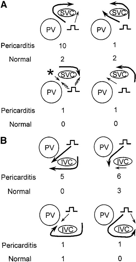 Variations In Right To Left Activation Across The Crista Terminalis