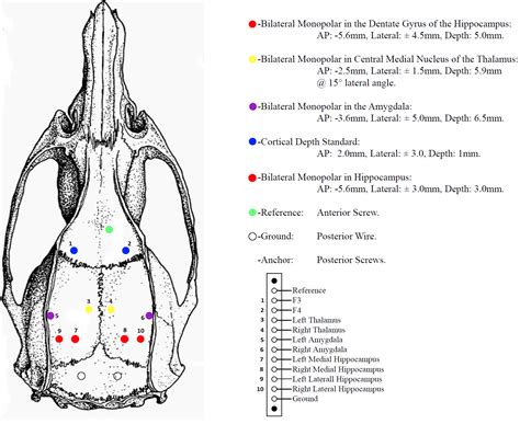 A New Method For Seizure Detection Using A Modified Kantz Algorithm For Lyapunov Exponent Estimation