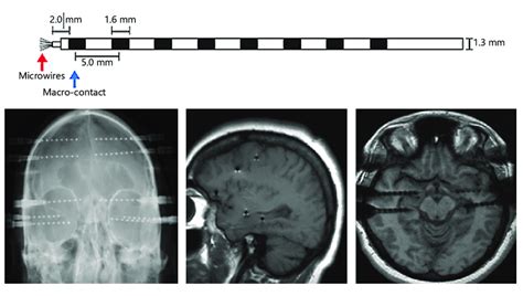 Single Neuron Electrophysiology Memory And Navigation Laboratory