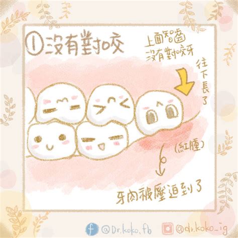 健康網智齒一定要拔嗎 牙醫2情況需拔除 自由健康網