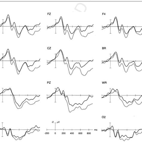 E Inter Trial Coherence Itc Differences Between Targets And Download Scientific Diagram