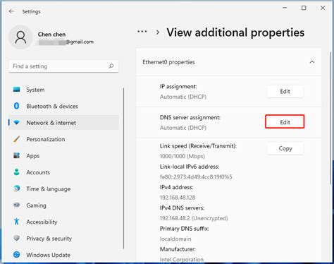 [2 Ways] How To Setup Dns On Windows 11 Step By Step Minitool