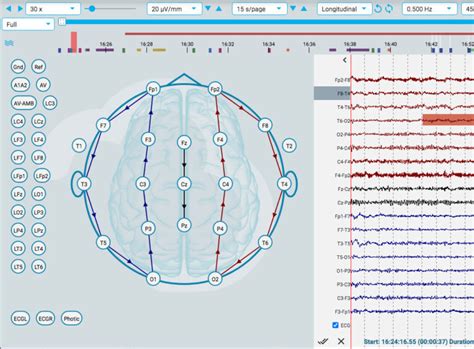 Clinical Eeg Software Stratuseeg